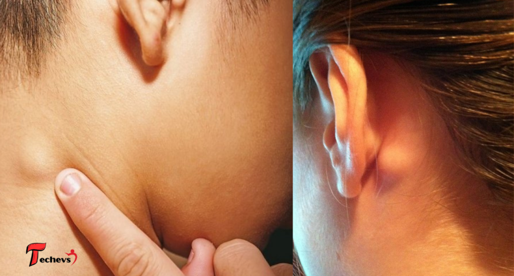 Do you have a lump in your neck, back, or behind your ear?